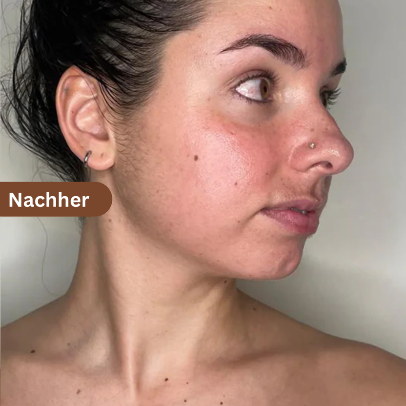 Aluvéa GloBrush für den Körper